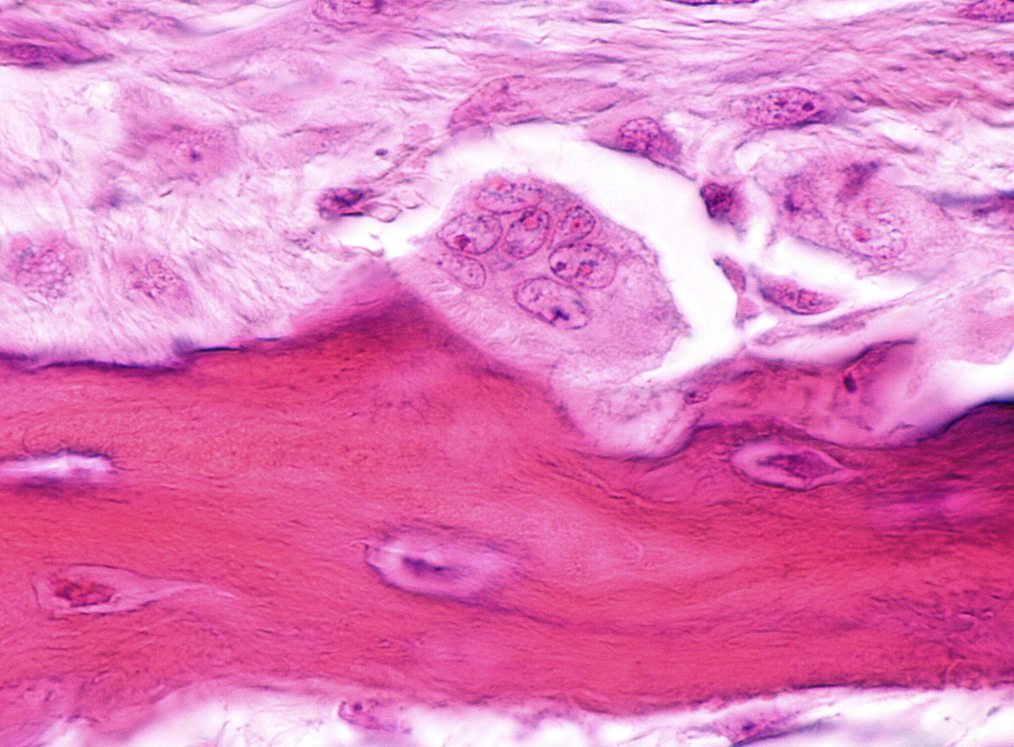 Bone Remodeling Process Bone Resorption Biogennix Bone Remodeling Process Bone Resorption Biogennix
